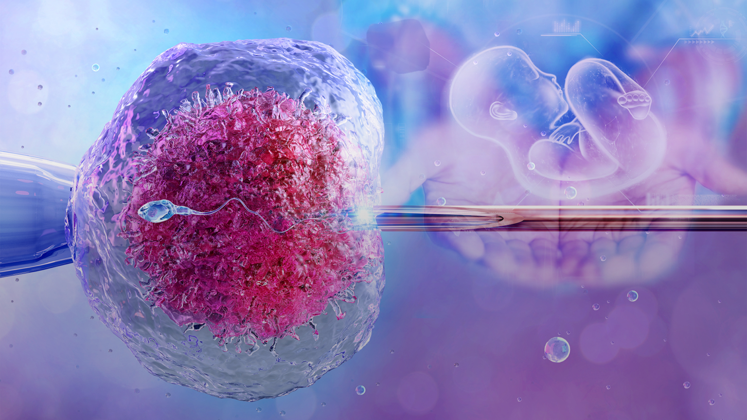 IVF Clinic in Madurai - Preethi Hospitals